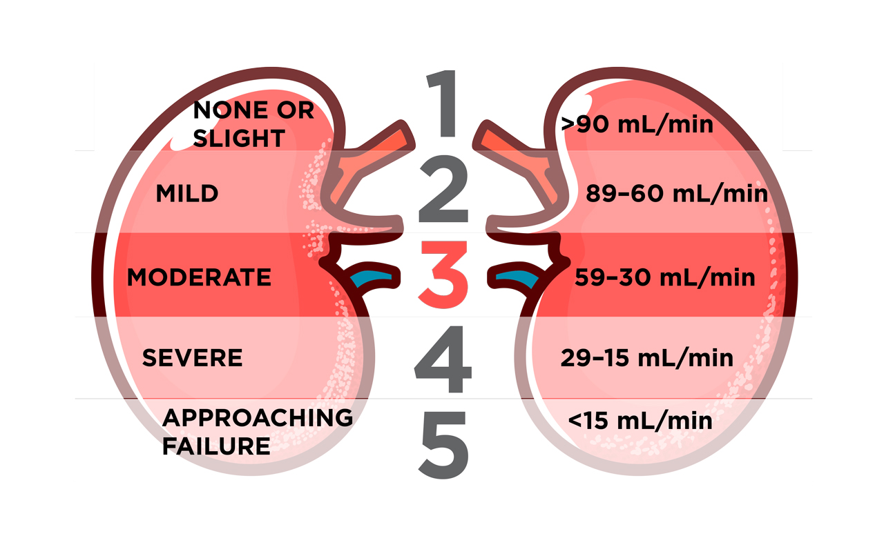 Experts update CKD guidelines